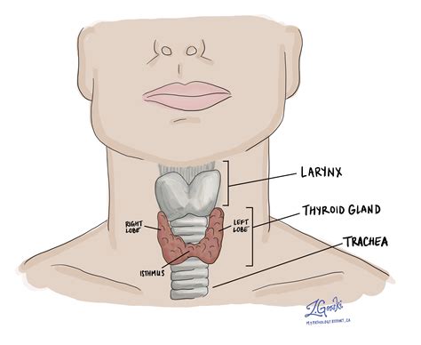 결절성 갑상선 과형성에 대한 병리 보고서 Mypathologyreport