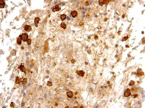 Cd30 Immunohistochemistry Download Scientific Diagram