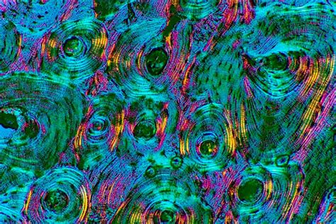 Compact Bone Tissue Micrograph