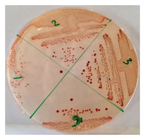 A Red Colonies Of A Baumannii On Chromagar™ Acinetobacter Agar B Download Scientific