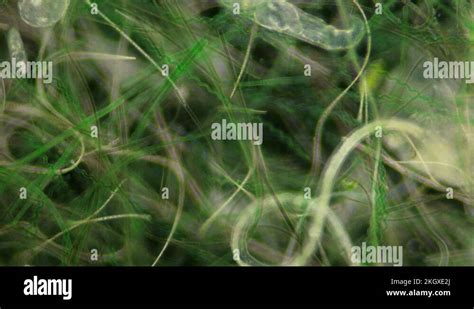 Algae Under The Microscope The Movement Of A Large Number Of Algae In