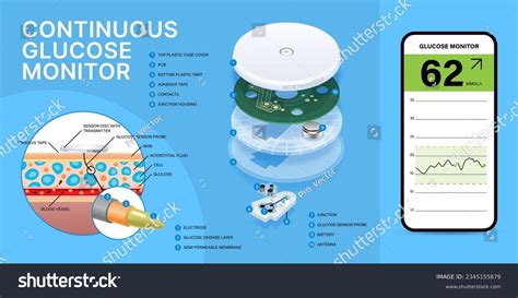570 Continuous Glucose Monitor Sensor Images Stock Photos Vectors Shutterstock
