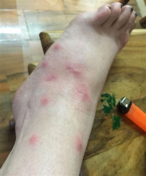 Vampire Horseflies Invade Birmingham Heres How You Should Treat