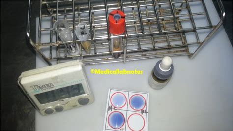 Brucella Antibody Test Introduction Test Result Test Method