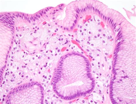 Pathology Outlines Question Bank