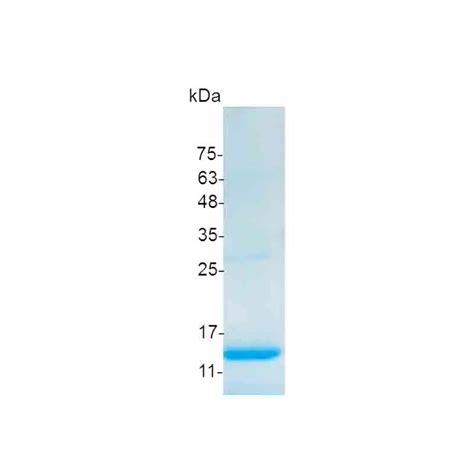 Ifn Gamma Mouse Atlantis Bioscience Pte Ltd Ifn Gamma Mouse Atlantis Bioscience Pte Ltd