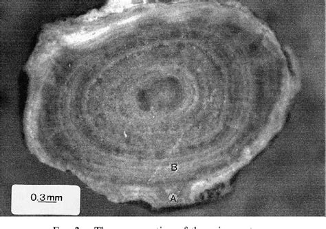 Figure 1 From Analysis Of Prostatic Stent Encrustation And Of Entrapped