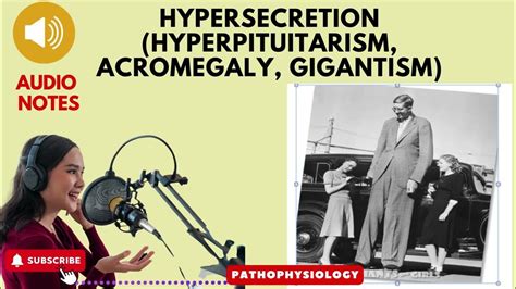 Hypersecretion Hyperpituitarism Acromegaly Gigantism Causes Signs Symptoms Treatment