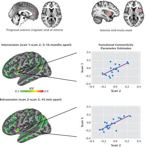Relationship Between Cingulo Insular Functional Connectivity And Autistic Traits In Neurotypical