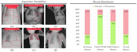 An Explainable Contrastive Based Dilated Convolutional Network With
