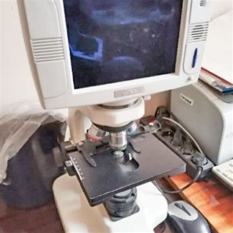 Dialog Boxes When Calculating The Area Of Objects In The Imagej Program Download Scientific