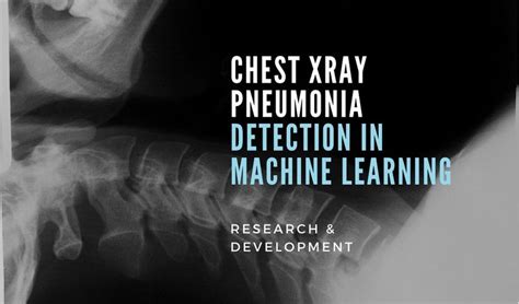 Chest Xray Pneumonia Detection In Machine Learning Research And Development Project Help