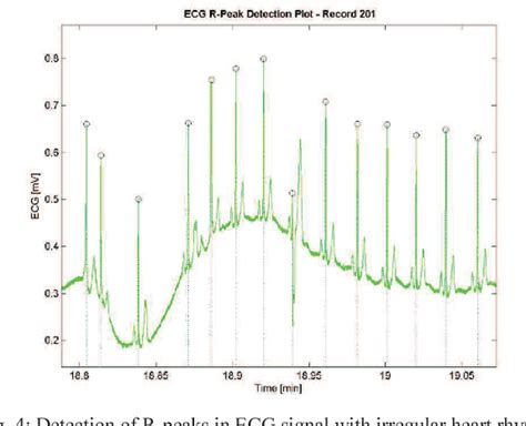 Figure 1 From Fast Fourier Transform For Feature Extraction And Neural Network For