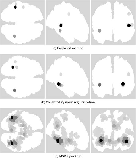 Figure 21 From Bayesian Meeg Source Localization With Possible Joint Skull Conductivity