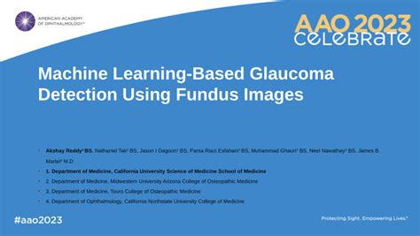 PDF Machine Learning Based Glaucoma Detection Using Fundus Images