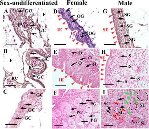 The Histomorphological Features And Germ Cell Developmental Patterns Of Download Scientific