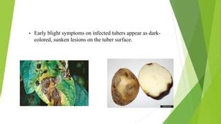 Early Blight Of Potato Pptx