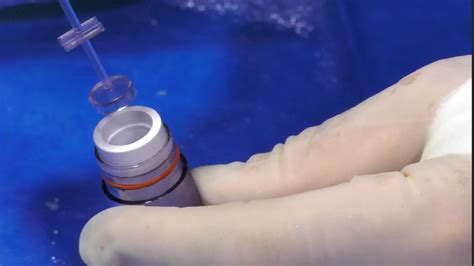 Arthrex Autocart™ Procedure For Cartilage Lesions In The Knee