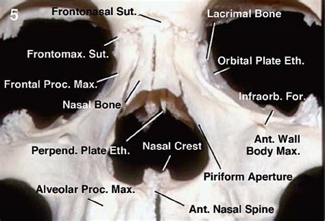 Anatomy Of The Nasal Cavity And Paranasal Sinuses Neupsy Key