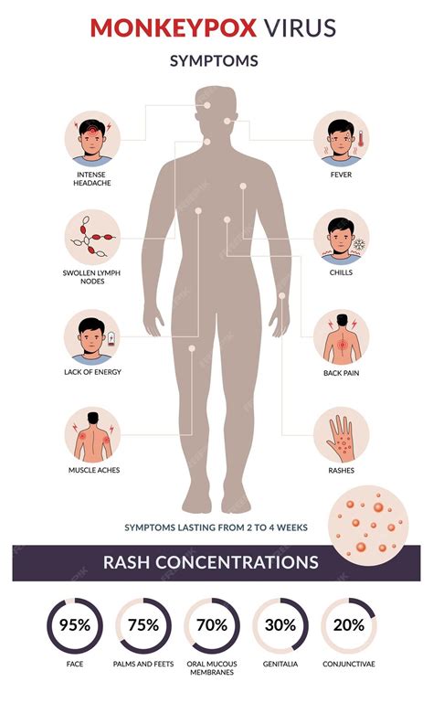 Premium Vector Monkeypox Virus Symptoms Flat Vector Infographic