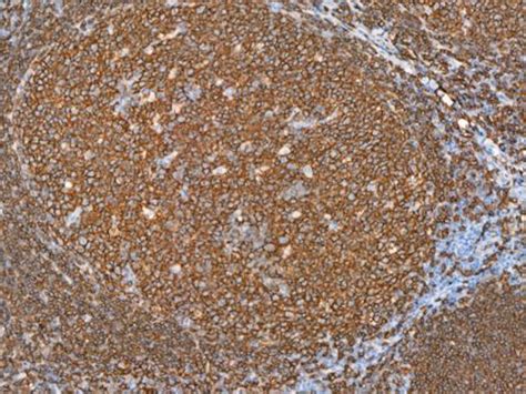 Cd20 [bc30] Biocare Medical