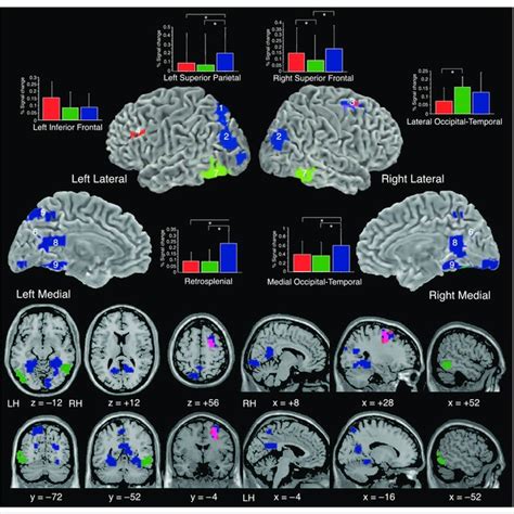 [pdf] reference frames for spatial cognition different brain areas are