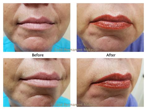 Permanent Makeup Lips Gone Wrong Saubhaya Makeup