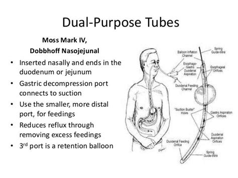 Gastric Tubes