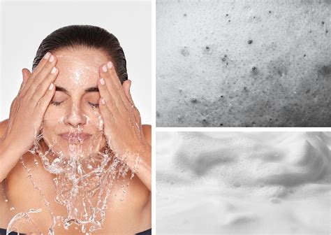 How To Reduce Large Pores Causes And Solutions 111skin 111skin