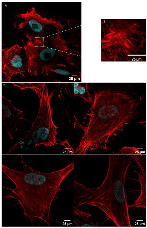 Visualization Of F Actin Through Expansion Microscopy Exm With