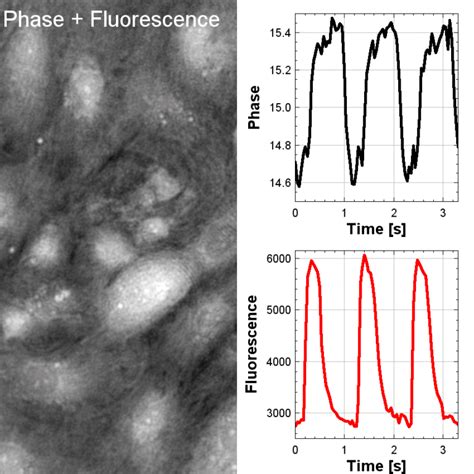 Temporal correlation LyncéeTec