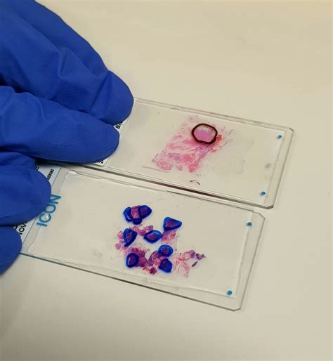 The Atgc Are Now Able To Perform Whole Exome Sequencing On Formalin