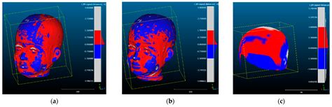 Craniofacial 3d Morphometric Analysis With Smartphone Based Photogrammetry
