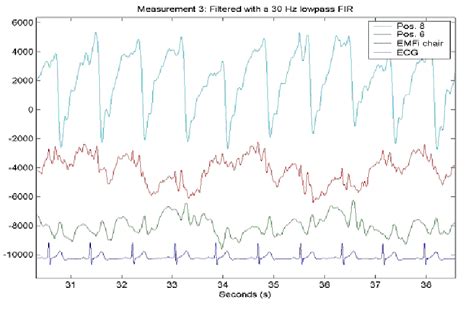 Measurement 3 Leg During Normal Respiration Signals Shown Download Scientific Diagram