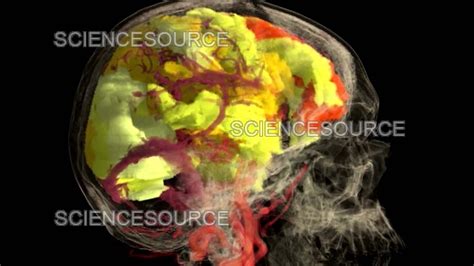 Orgasm Climax FMRI Stock Image Science Source Images
