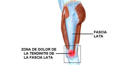 Descubre El Secreto Del Reflejo Extensor Cruzado ¡mejora Tu Salud