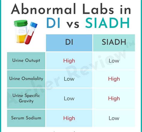 Di Vs Siadh Medizzy Di Vs Siadh Medizzy