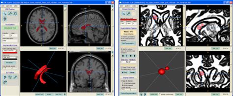 Left Itk Snap User Interface Shows Three Orthogonal Views Of A Download Scientific Diagram