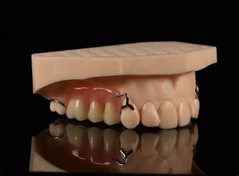 Acrylic Removable Partial Denture Supplier Affordable Acrylic Partial Denture Cost