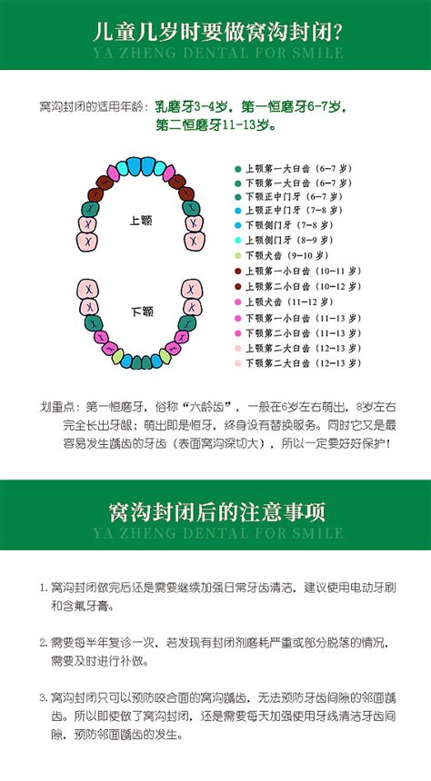 窝沟封闭 3