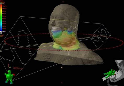 Varian Eclipse Alternatives And Similar Software Alternativeto