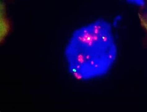 Abnova™ Erbb2 Her2cen17q Fish Probe Erbb2 Her2cen17q Fish Probe