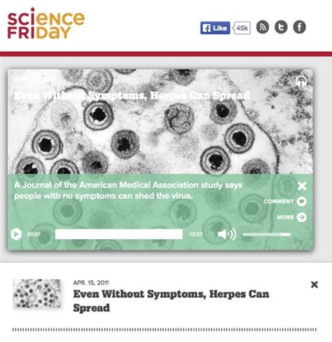 New Herpes STD Information