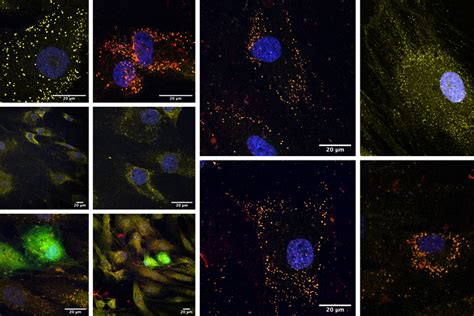 Confocal Microscopy Iqs