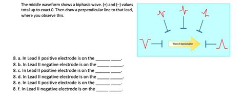 Solved The Middle Waveform Shows A Biphasic Wave And