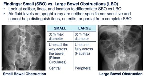 Plicae Circulares X Ray