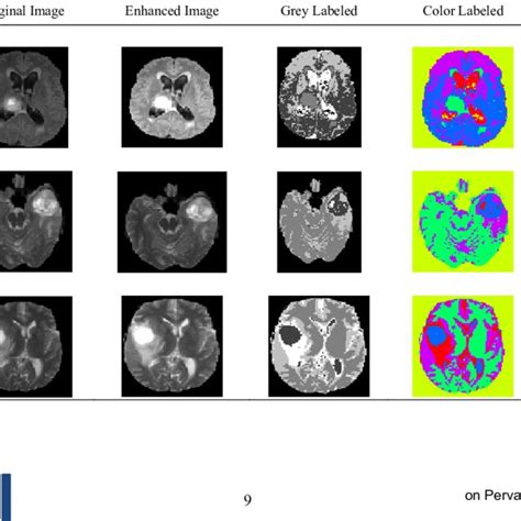 Image Segmentation Using K Means Download Scientific Diagram