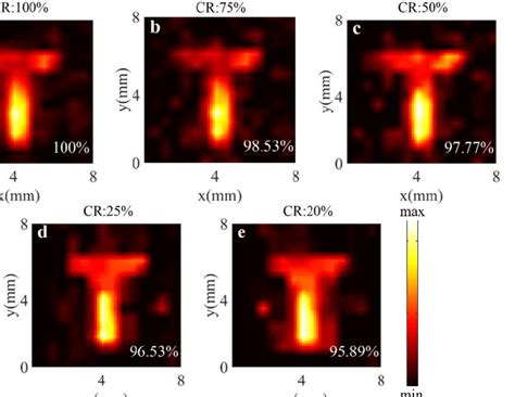 Reconstruction Effect With An Under Sampled Measurement At Z 6 Mm Download Scientific Diagram