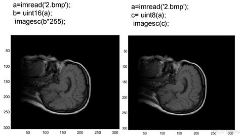 《dip数字图像处理》复习笔记 5图像编码基础（图像压缩、冗余、编码定理，霍夫曼huffman编码、香农shannon Fano编码、算术编码、lzw字典编码、行程编码、预测编码、变换编码