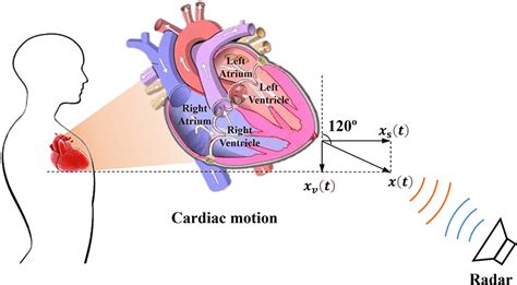 Schematic Diagram Of Radar Cardiac Motion Detection And The Download Scientific Diagram